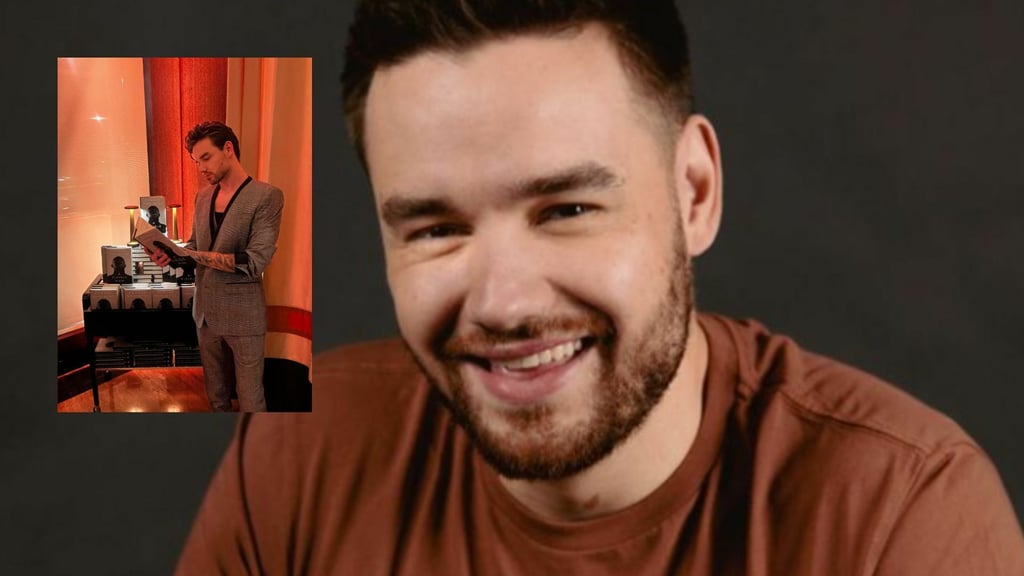 Liam Payne Y La Transformación De Su Rostro De La Que Todos Hablan En