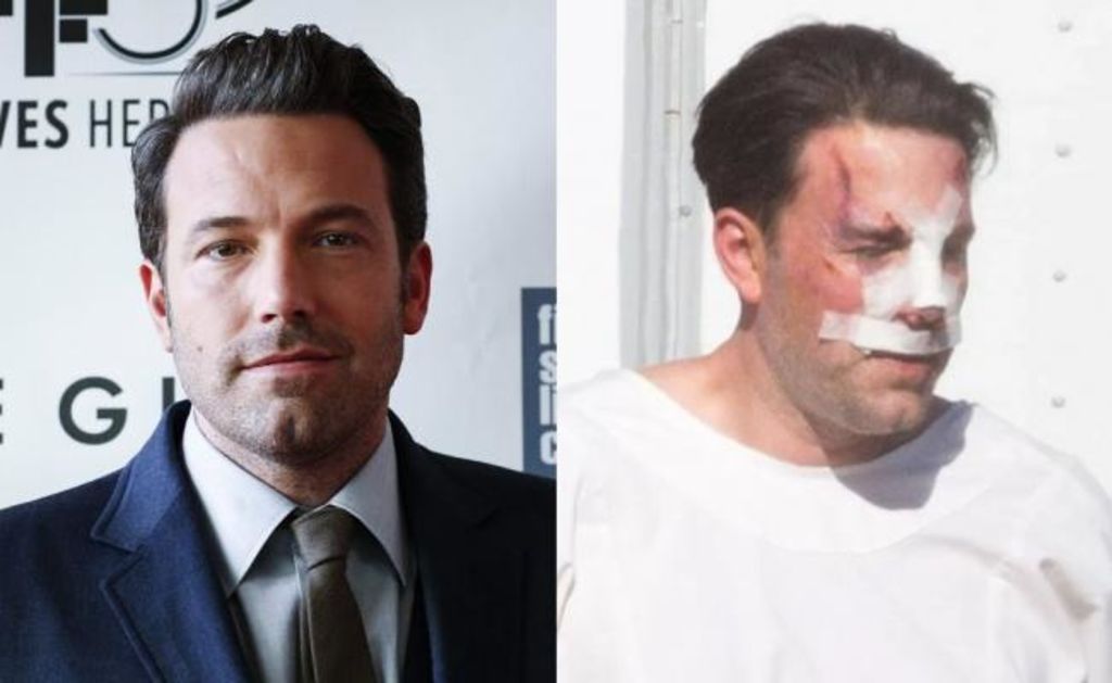 ¿Qué le pasó al rostro de Ben Affleck?