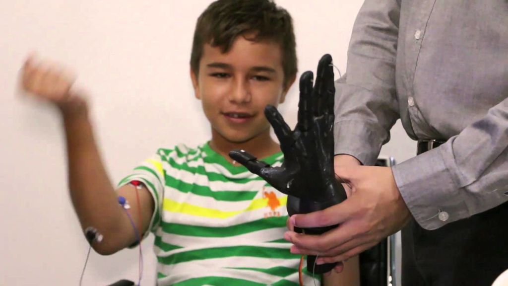 Markoptic, fundación que desarrolla prótesis robóticas para niños