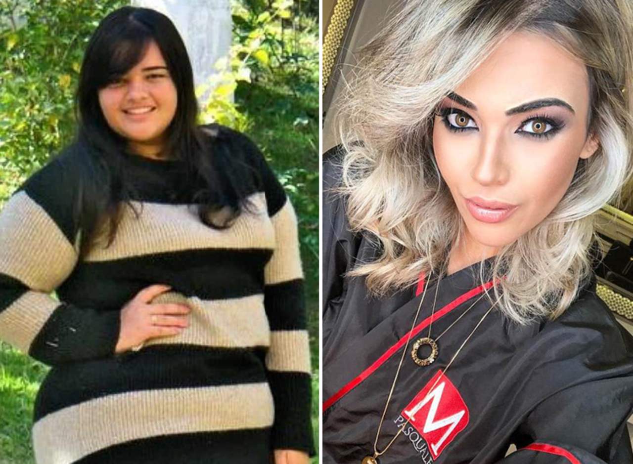 Pierde 81 kilos y presume su nueva figura