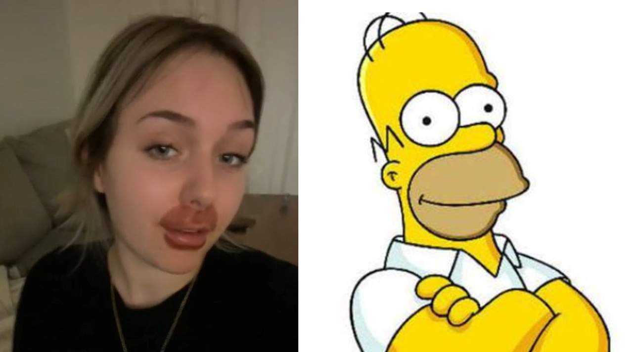 Intenta aumentar el grosor de sus labios y termina pareciéndose a ...