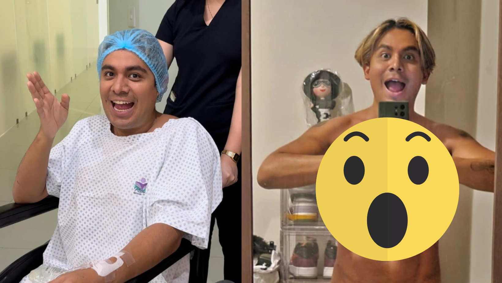 FOTOS: El increíble antes y después de Ricardo Peralta tras someterse a ...