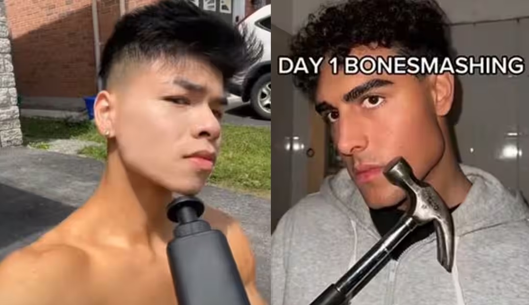 ¿En qué consiste el reto viral 'bone smashing'?